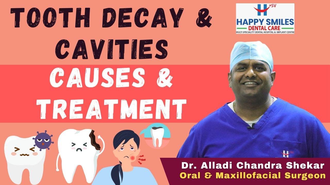 What Causes Tooth Decay? Cavity || Causes || Treatment - YouTube