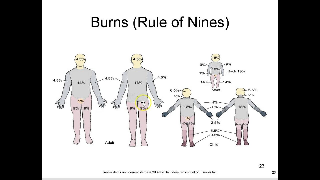 Trauma part 1 - YouTube