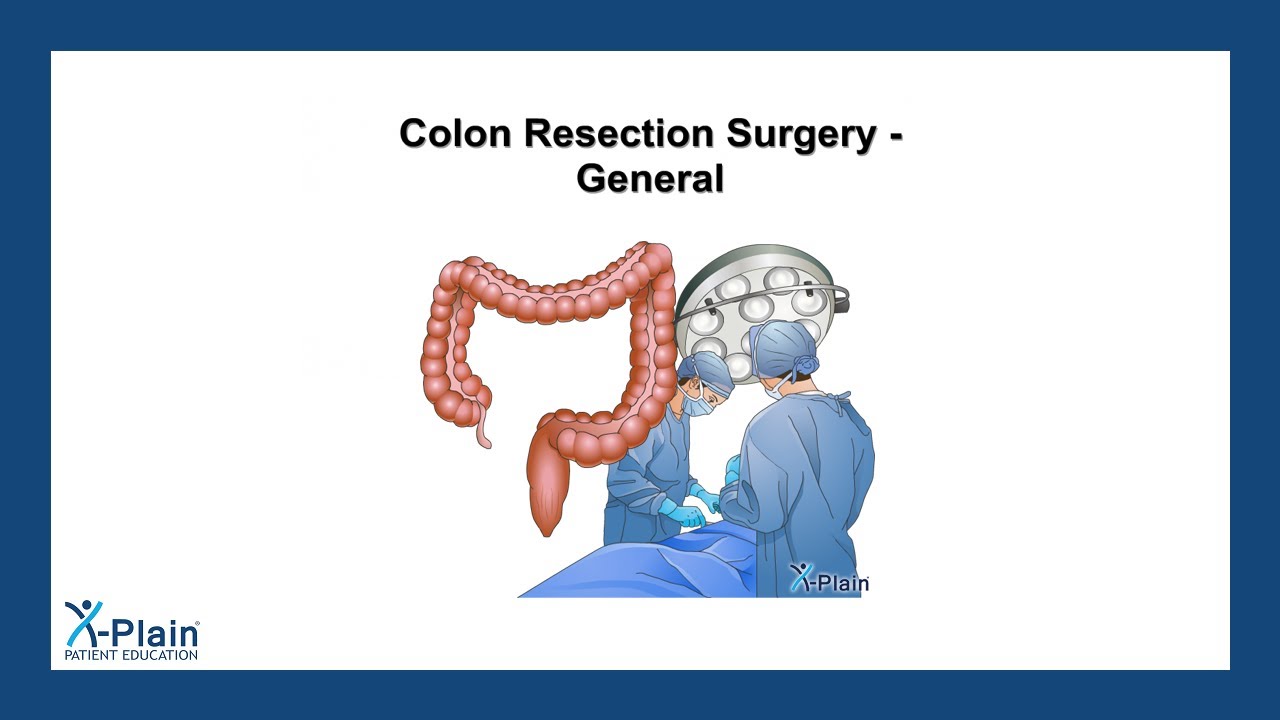 Colon Resection Surgery - General - YouTube
