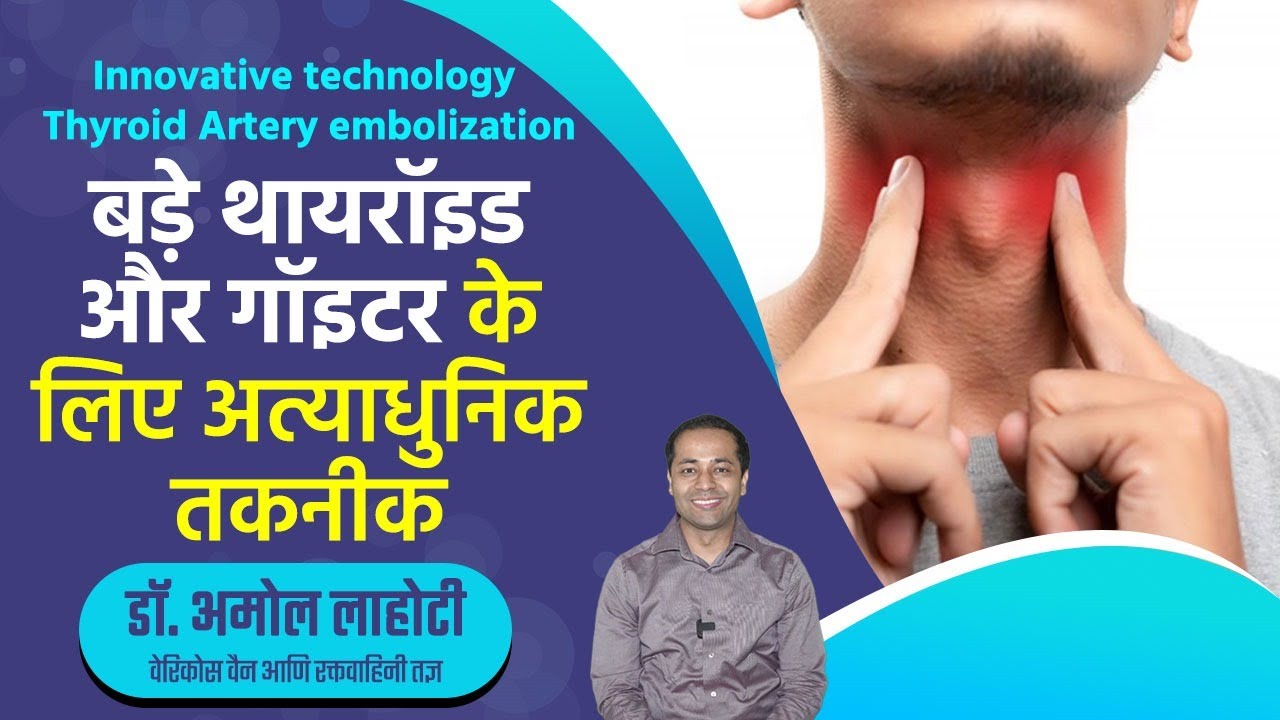 Most Innovative Treatment for Goiter & LargeThyroids: Thyroid Artery ...