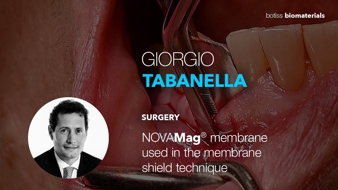 The magnesium membrane shield technique using the NOVAMag® membrane by ...