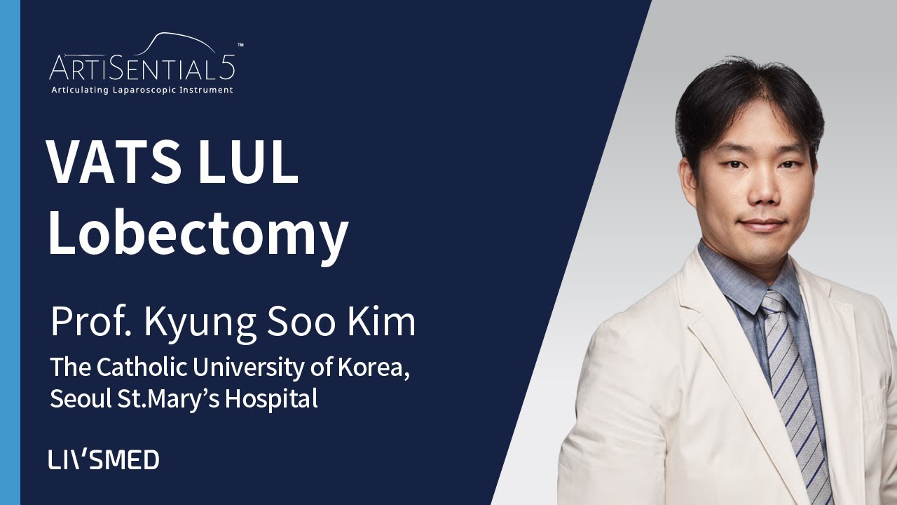 VATS LUL Lobectomy - Prof. Kim, Kyung Soo - YouTube