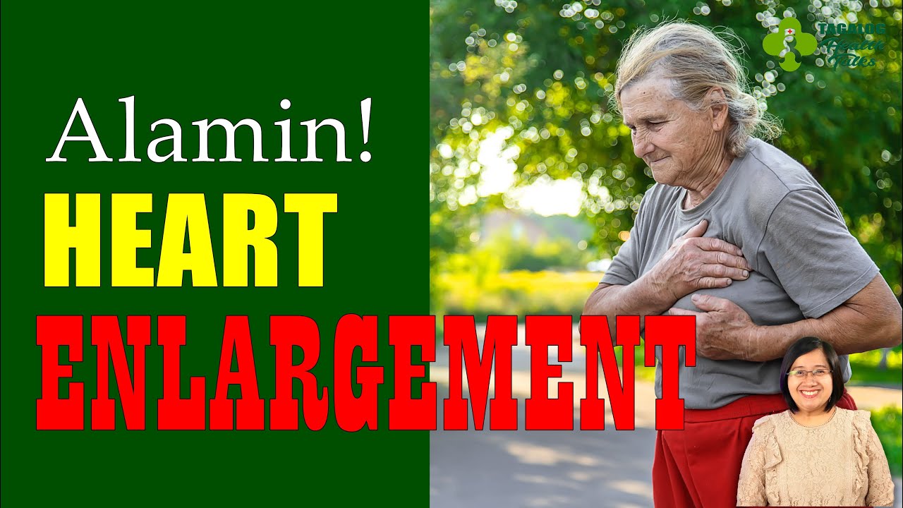 Ano ang CARDIOMEGALY ~ Babalik pa ba sa normal kapag uminom ng GAMOT ...