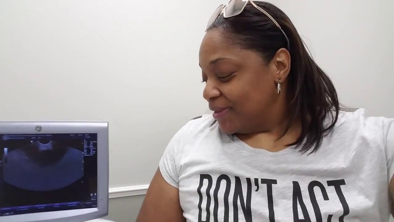TTC Cycle 13, Day 11: IVF Stims Day 7 | 2nd Follicle Scan | LIVE ...