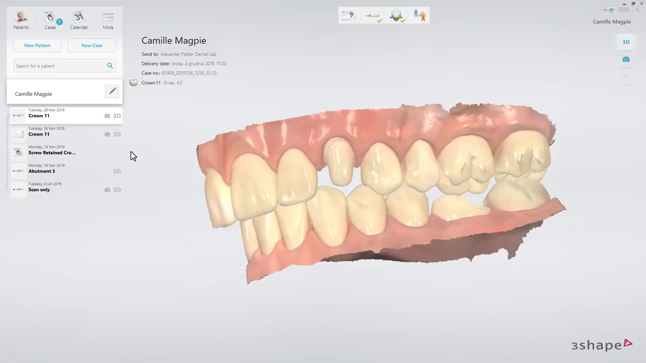 3Shape TRIOS How to re send a scan - YouTube