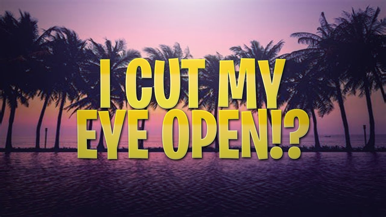 I CUT MY EYE OPEN!? (Story #2) - YouTube