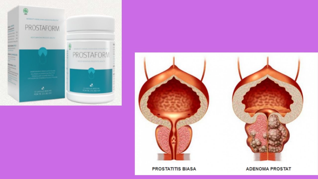 👉 Prostaform Asli - Ulasan, Manfaat, Bahan,!Harga - YouTube