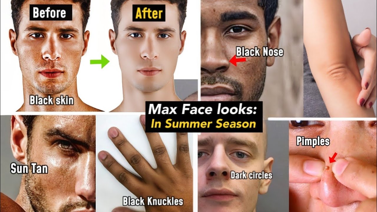 Max Face Looks ( in Summer Season ).5 Hacks To Have Better Looking Face ...