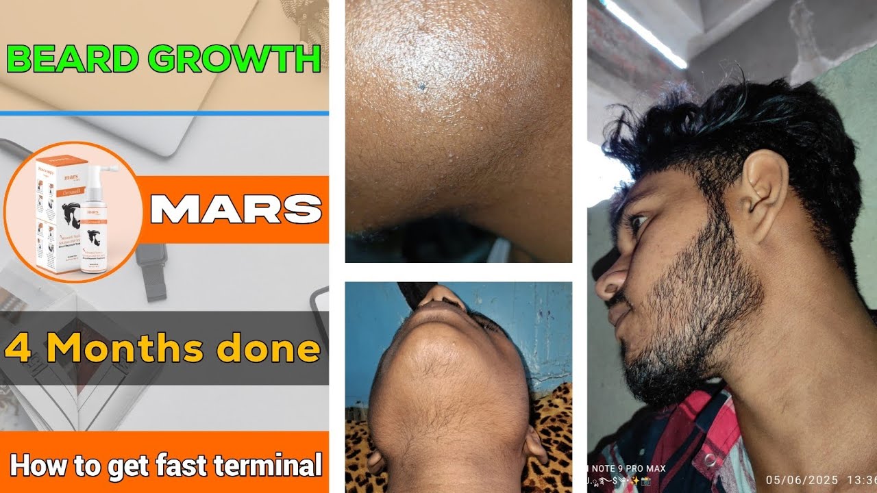 BEARD GROWTH ! How to get fast terminal ! 4 months done ️ Get fully ...