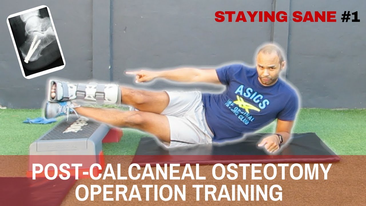 Staying Sane Workout 1 | Post-Calcaneal Osteotomy Operation Training ...