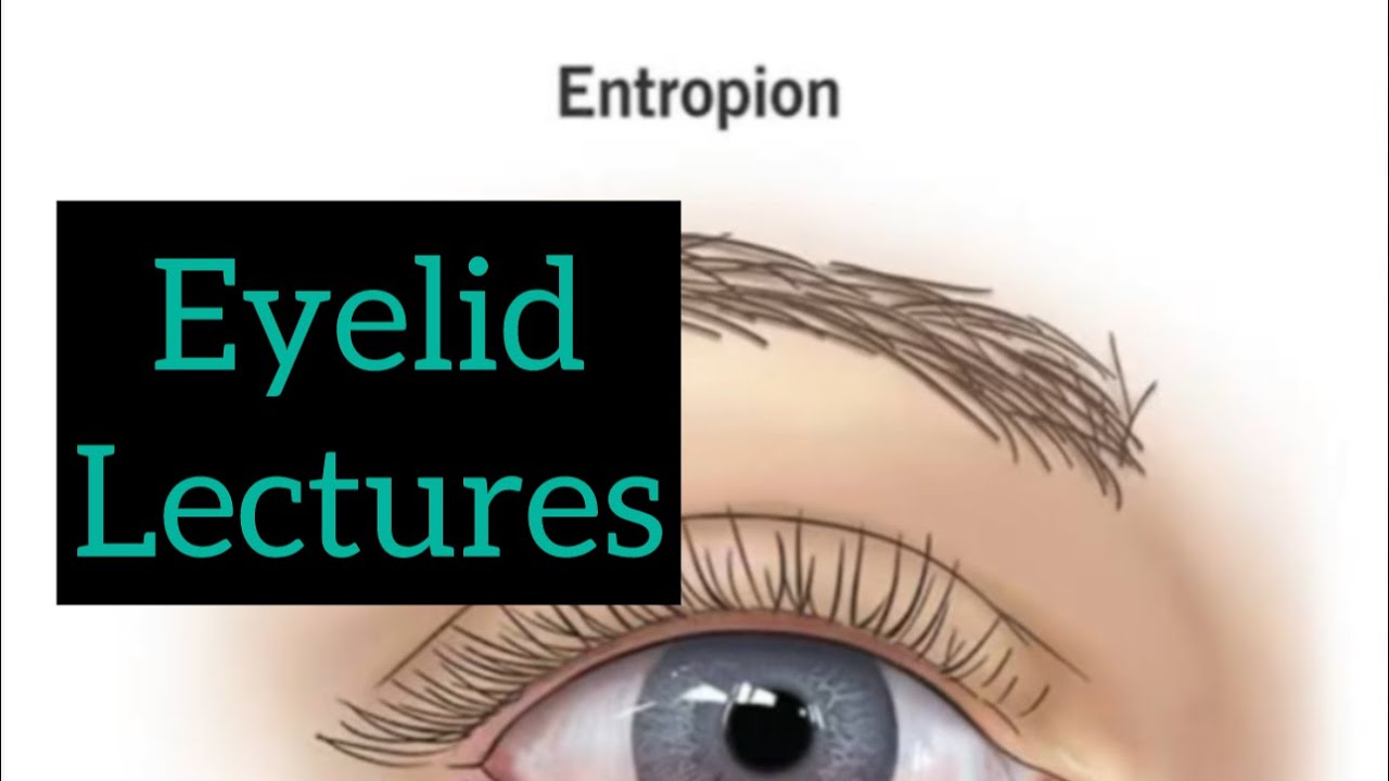 Eyelid lectures part 7, Eye/ opthalmology lectures , #eyelectures # ...