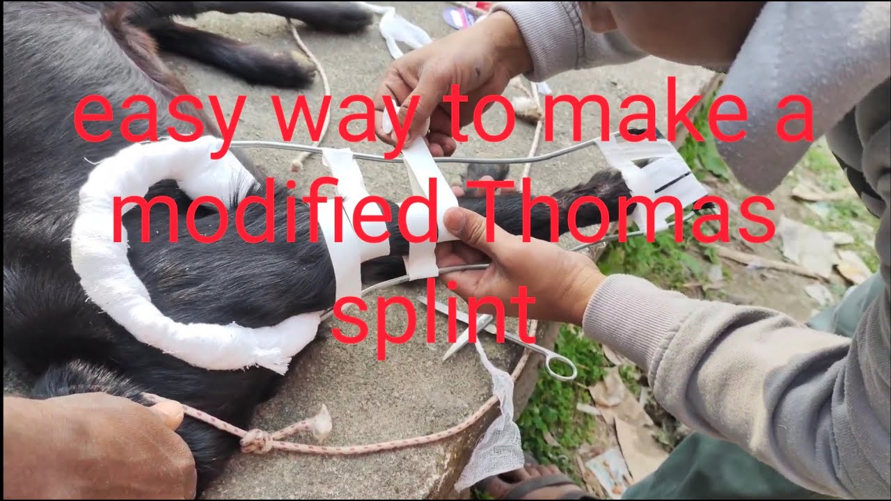 EASY METHOD OF MAKING A MODIFIED THOMAS SPLINT 🙂 - YouTube