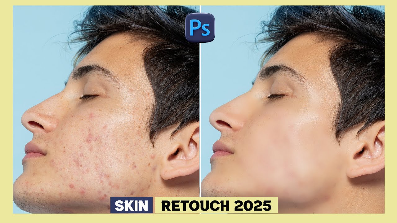 How to Remove Acne - Photoshop Tutorial For Beginners 2025 - YouTube