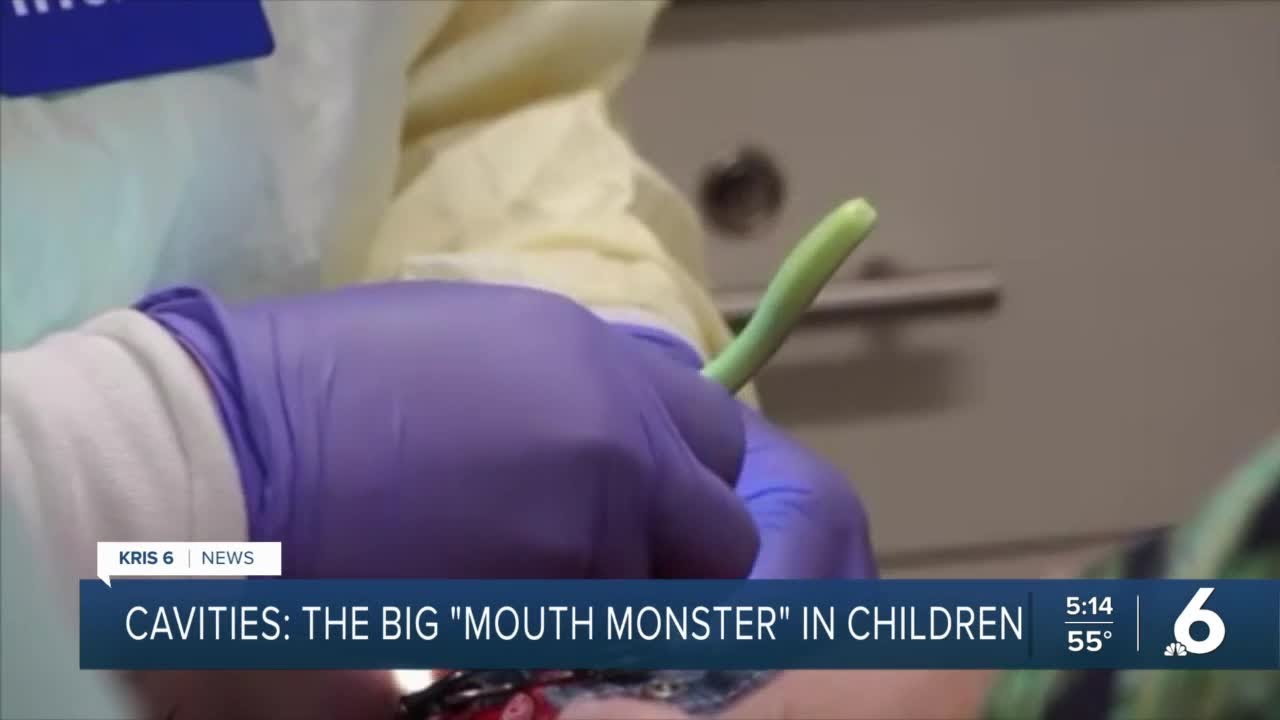Cavities are the #1 mouth monsters in children - YouTube