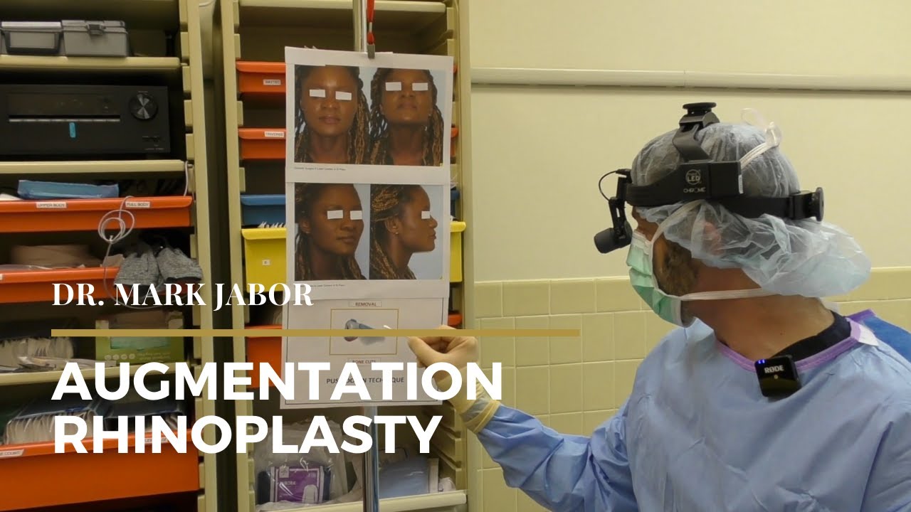 Augmentation Rhinoplasty | Dr. Mark Jabor - YouTube