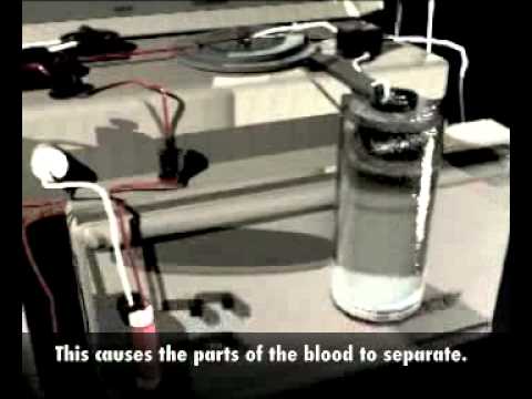 Apheresis Machine Simulation - YouTube
