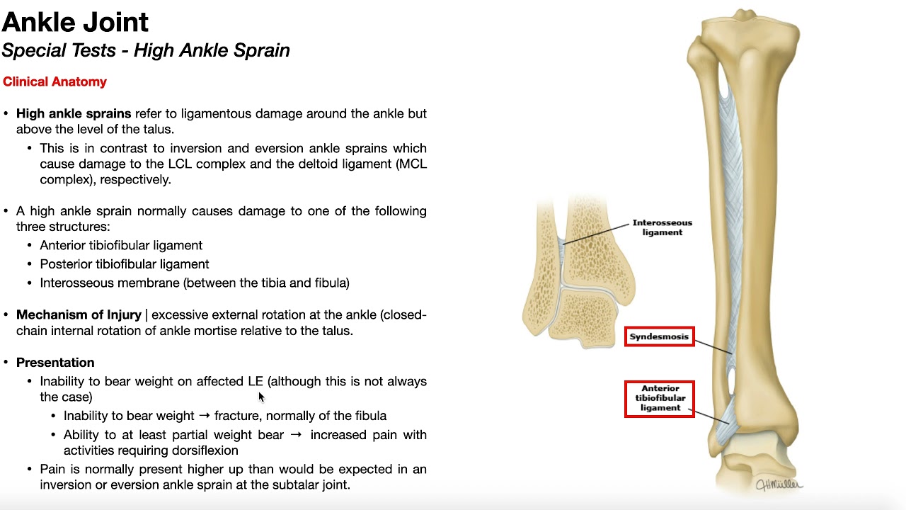 High Ankle Sprains | Anatomy, Presentation, Diagnosis, & Treatment ...
