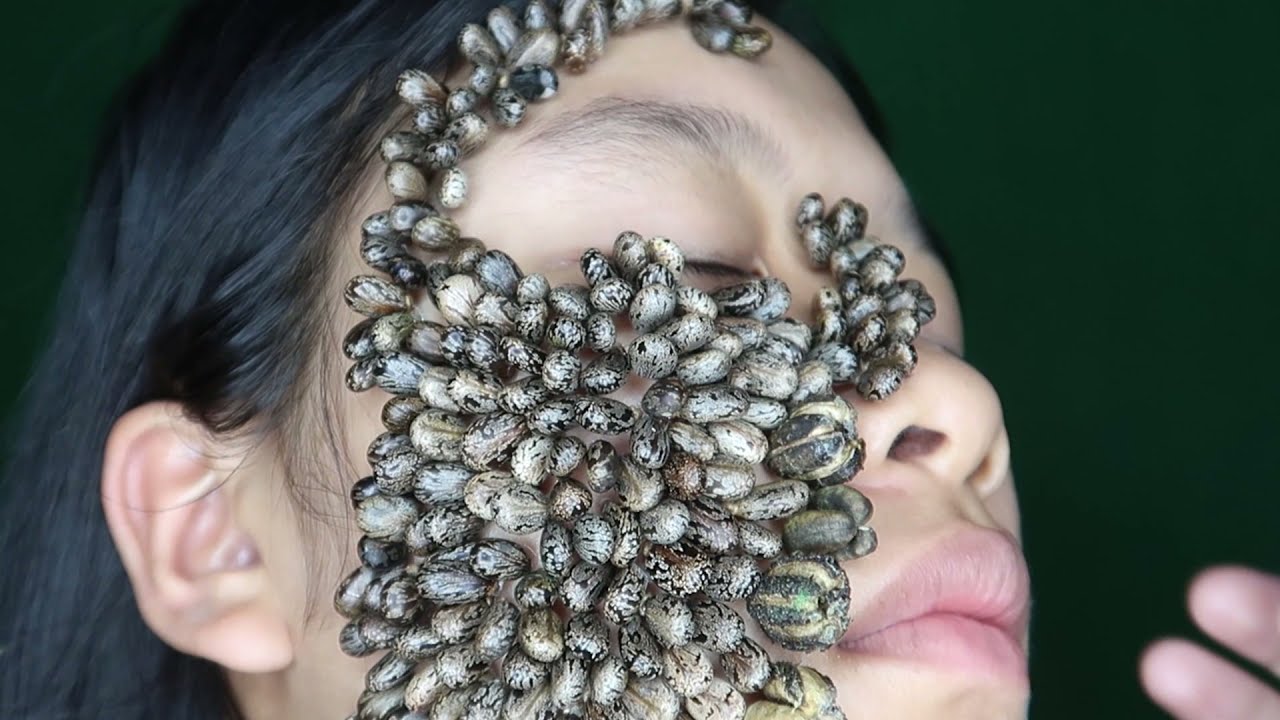 Treat ticks on the face! - YouTube