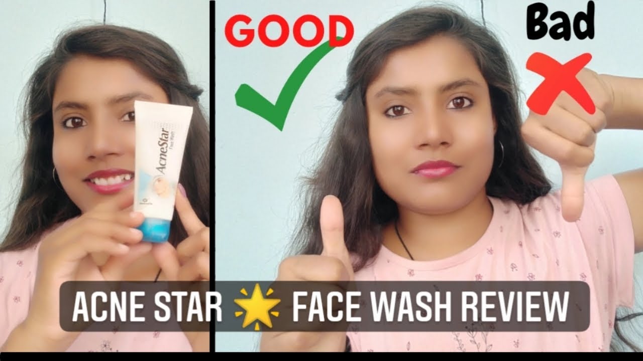 Acne star 🌟 Face wash Honest Review /Acne star face wash Review in ...
