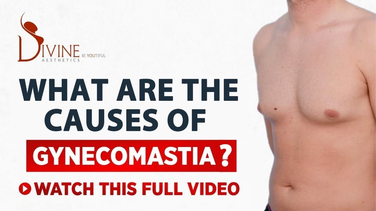 What are the Causes of Gynecomastia | Prevention | Treatment of ...