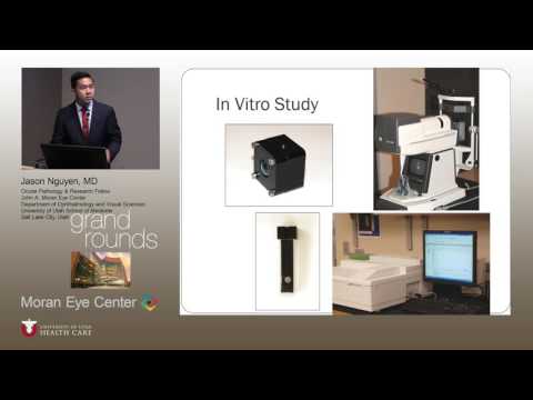 Intraocular Lens Power adjustment by Femtosecond Laser - YouTube