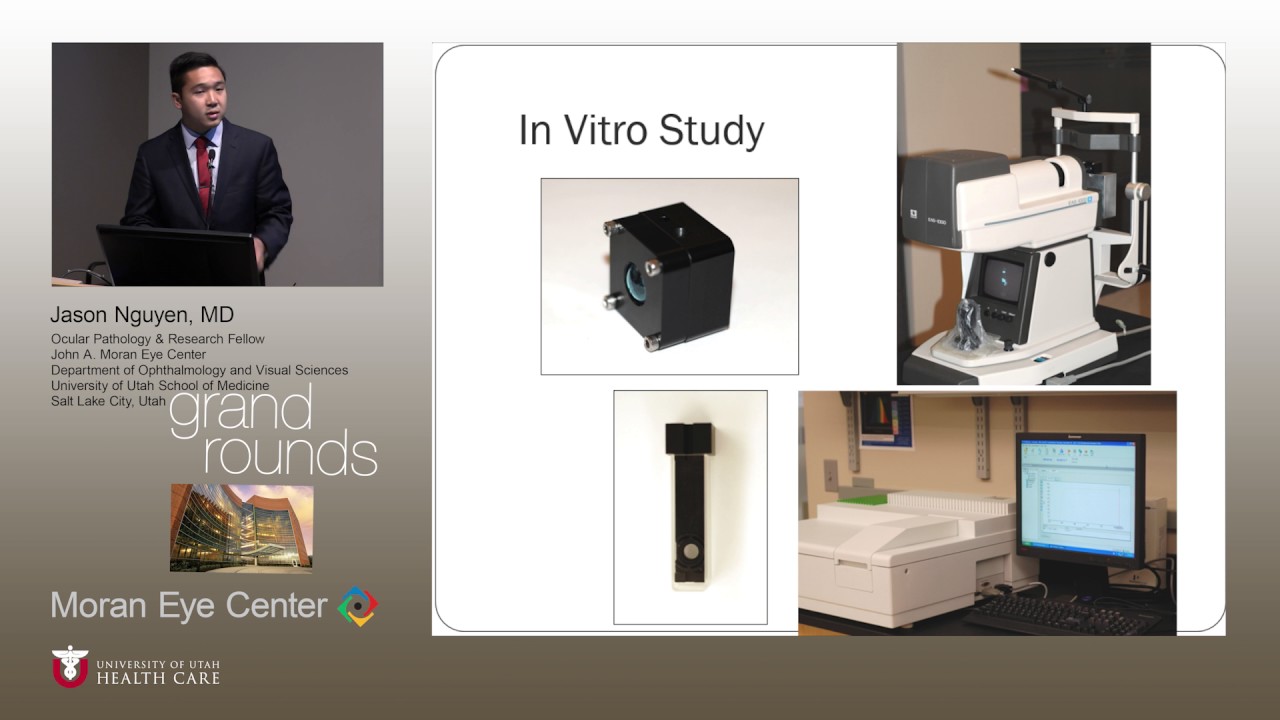 Intraocular Lens Power adjustment by Femtosecond Laser - YouTube