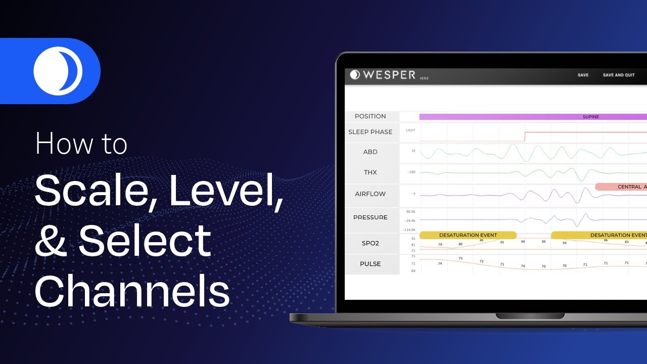 Wesper - Scaling, Leveling & Channel Selection - YouTube