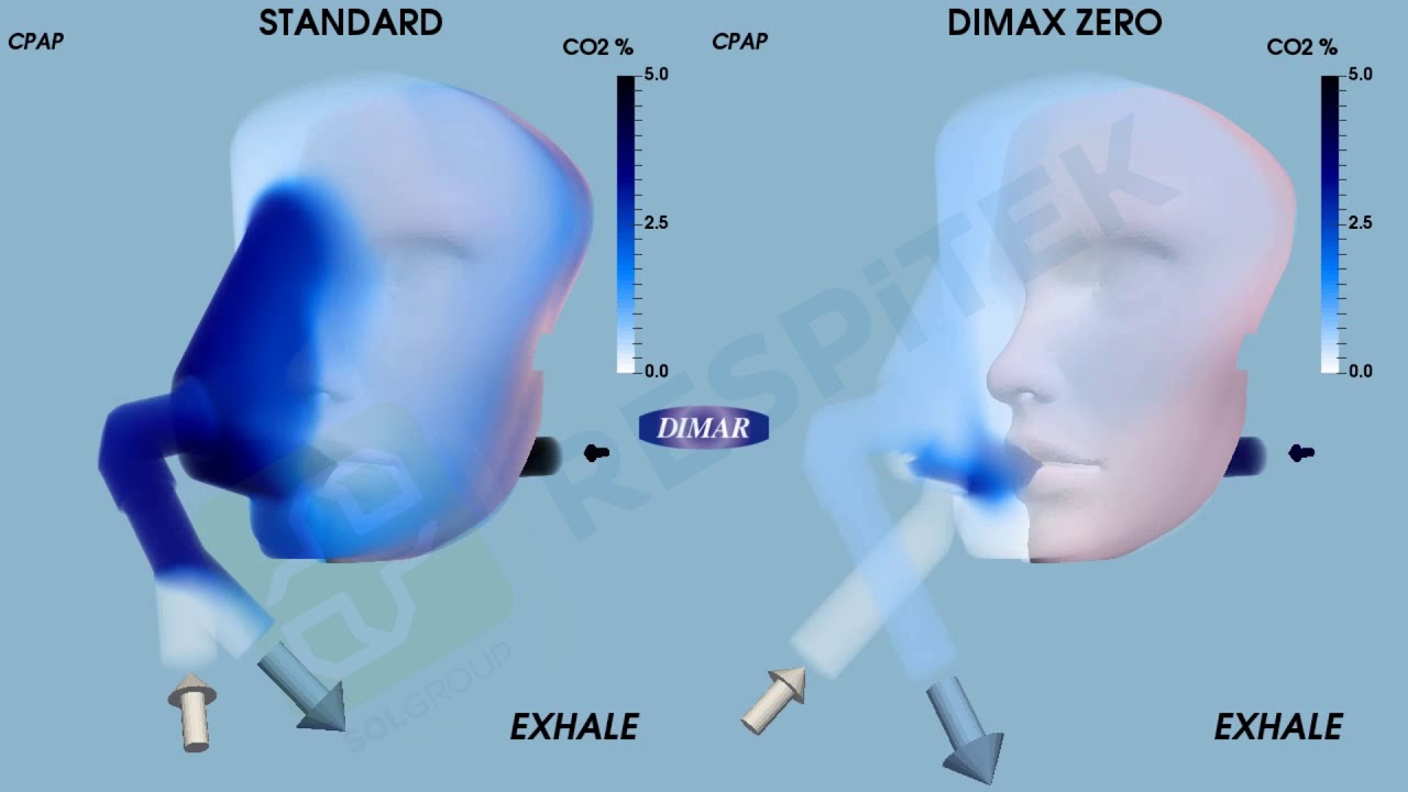 Dimax Zero - CPAP NIV - YouTube