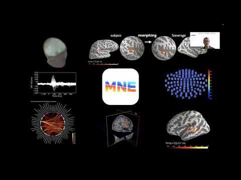 MEGIN Masterclass : Analysing MEG data with MNE-Python and its ...