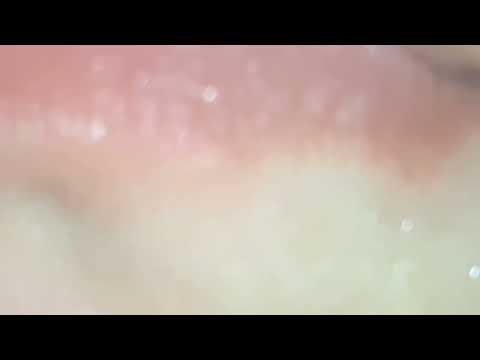 Pulling my boyfriend's uvula in slow-motion - YouTube