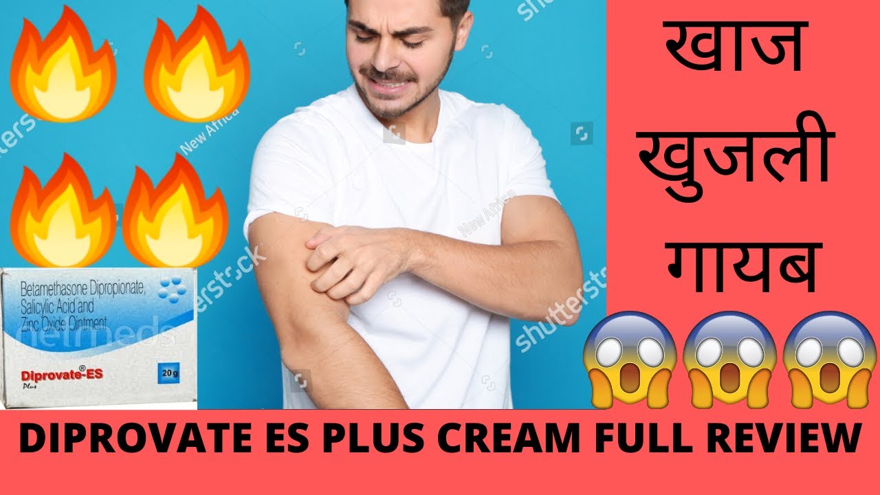 Diprovate ES Cream Full review Effects and Side Effects Best for Fungal ...