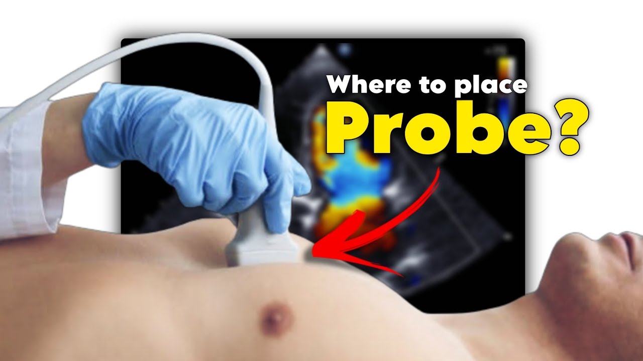 The Art of Probe Positioning: Mastering 2D Echo - YouTube