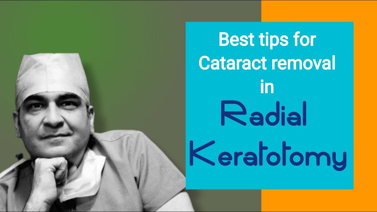 Post RK cataract surgery (Radial Keratotomy) deep multiple cuts . step ...