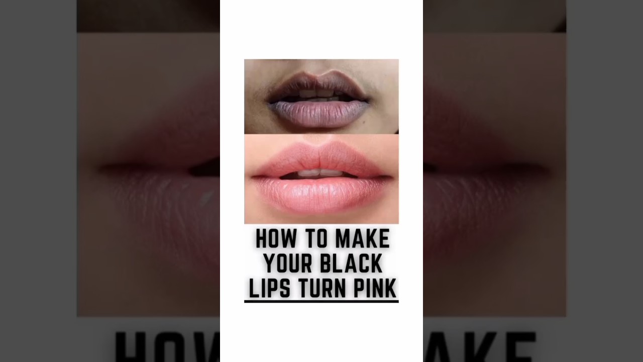 How to make your black lips turn pink# pink baby lips💋 - YouTube
