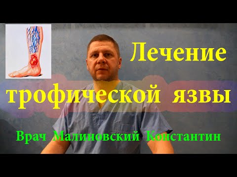 Бесценный Рецепт Мази от трофических язв. ПРОВЕРЕНО. 100% результат ...