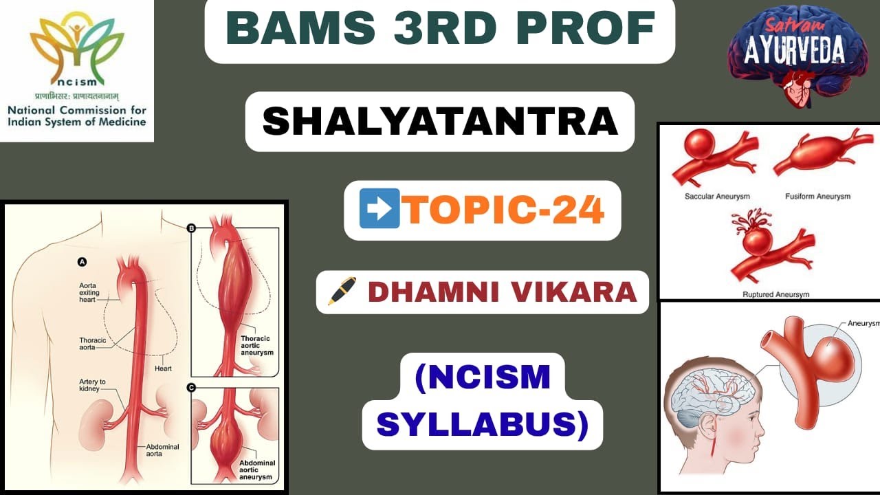SHALYA TANTRA TOPIC -24 DHAMNI VIKARAS (TERM 2ND) ACCORDING TO NEW ...