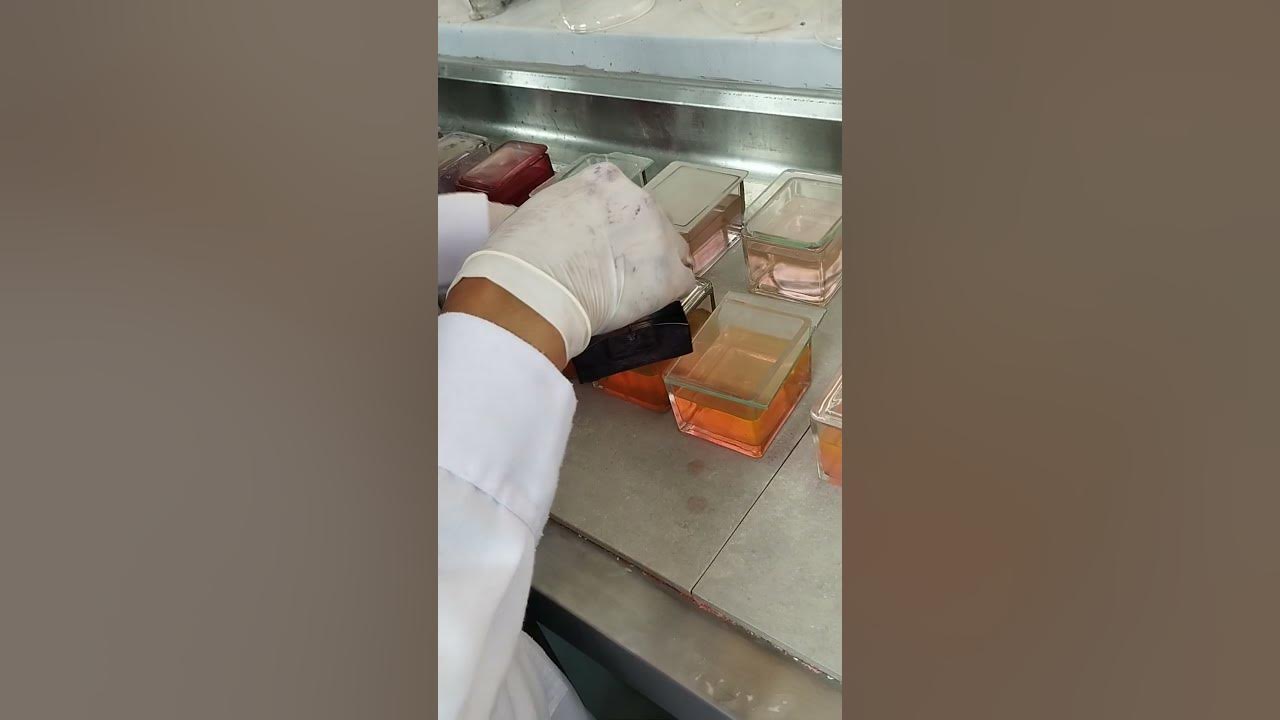 Coloración de Verhoeff - Parte 6 - YouTube