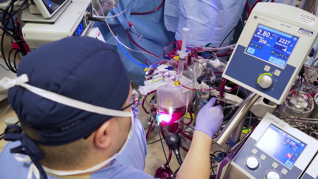 Cold Head-Warm Body Perfusion: A Guide to Isolated Cerebral Perfusion ...