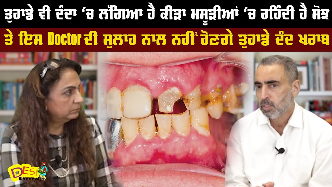 How to cure Teeth Pain | How to Relieve Teeth Pain | Yellow Teeth | How ...