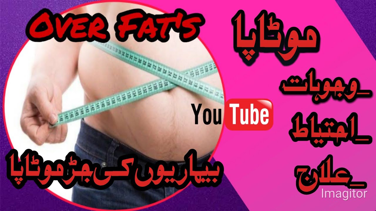 Motapa(Obesity) Causes, Symptoms, Diagnosis, Treatment. Complication of ...