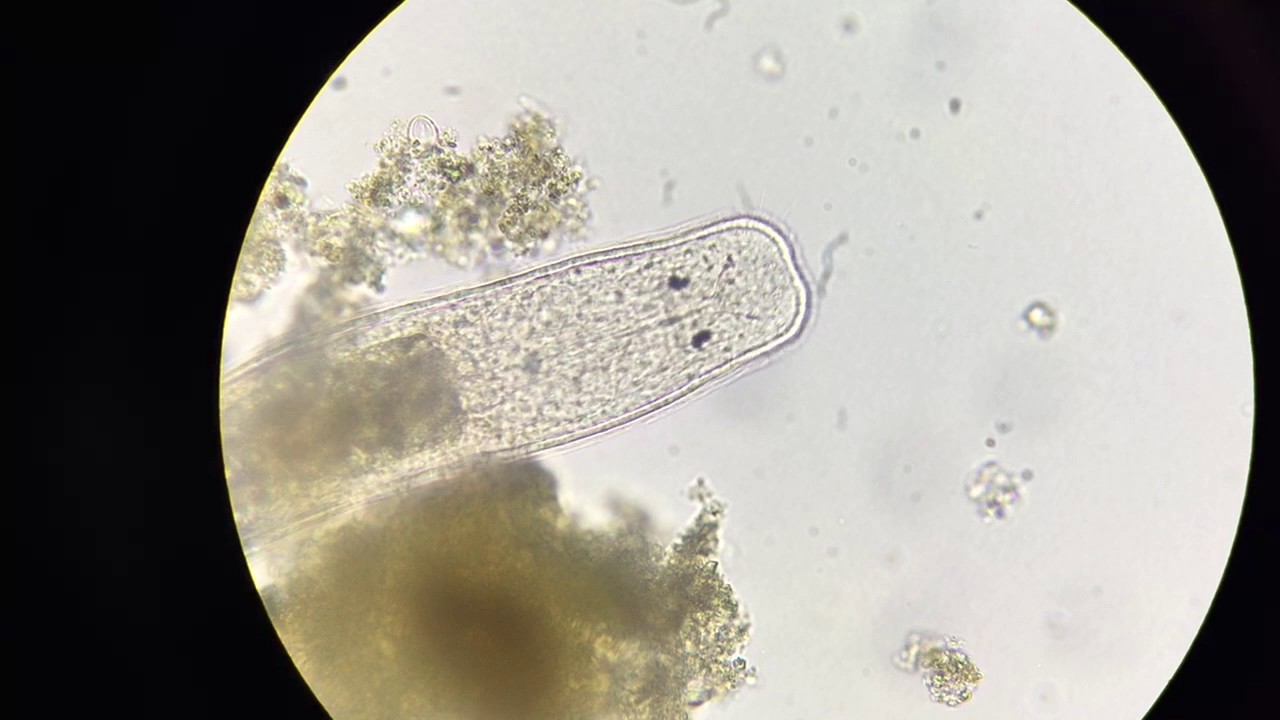 Life in a Single Drop of Water - YouTube
