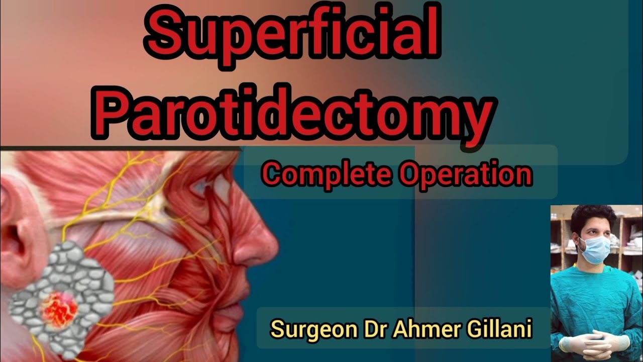 Superficial Parotidectomy part 1 - YouTube