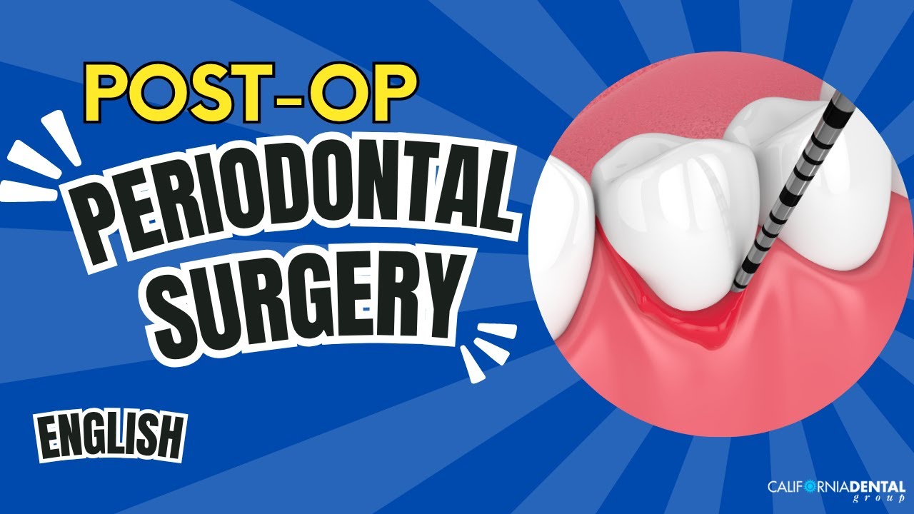 Post op Instructions - Periodontal Surgery - English - YouTube