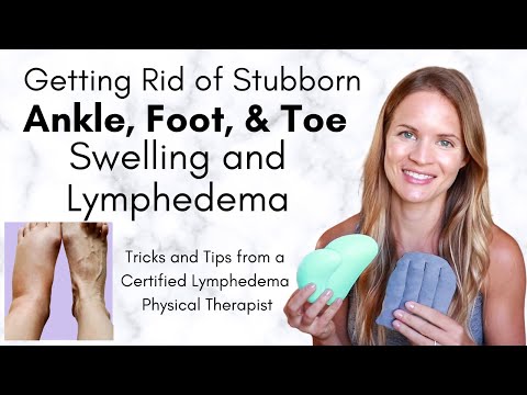 Toe, Foot, and Ankle Lymphedema and Swelling - Tricks to get Rid of Stubborn Lymphedema