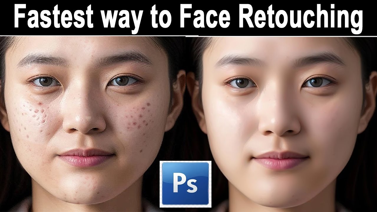 Fastest way to Face Retouching। How To Easily Remove Acne & Blemishes ...