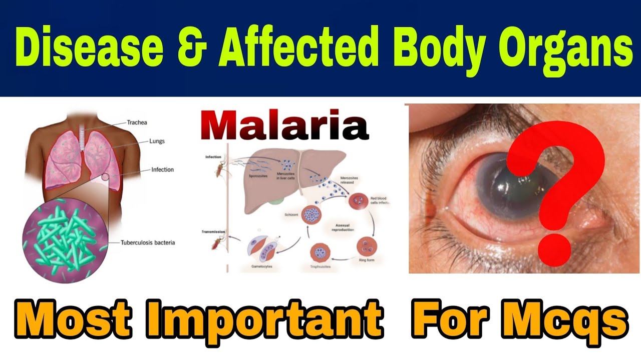 Different Disease and Affected Body Organ|Thebestnurse| - YouTube