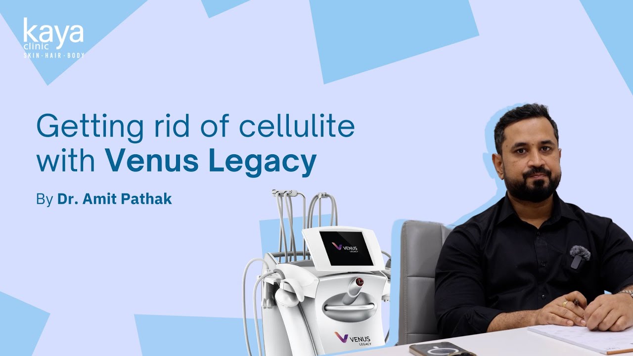 Get Rid of Cellulite with Venus Legacy | Expert Talks | Dr. Amit Pathak ...