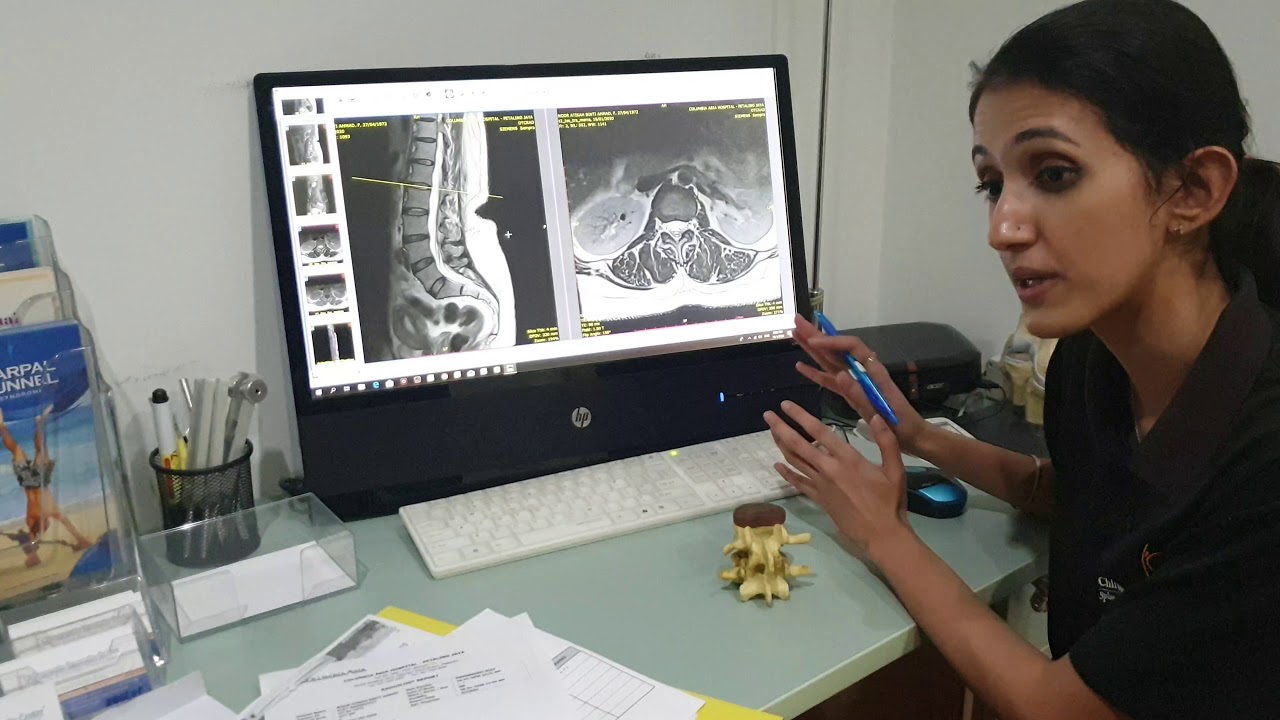 Rawatan Kiropraktik untuk masalah saraf sciatica - YouTube