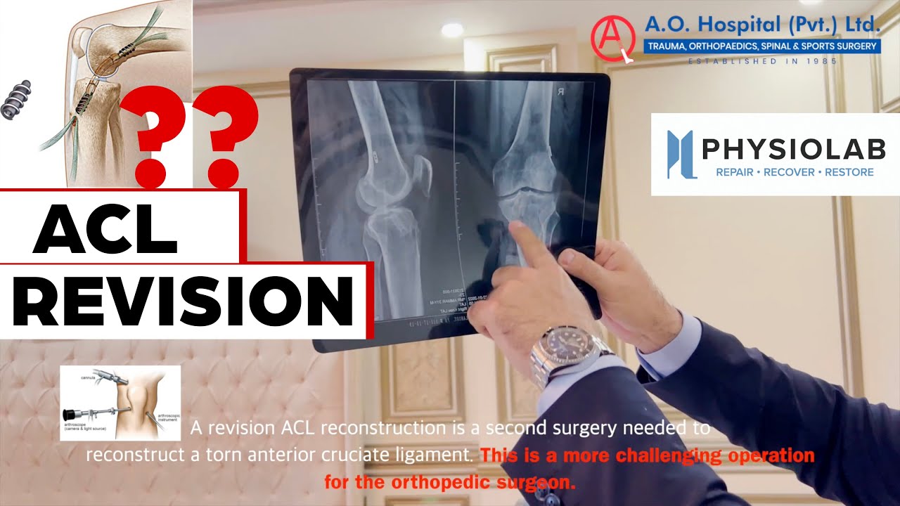 ARTHROSCOPIC ACL REVISION - YouTube