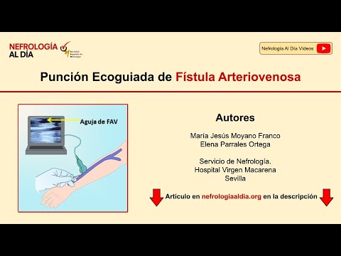 Punción Ecoguiada del Acceso Vascular - YouTube